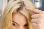 Hot Roots - 6 Easy Ways To Get Rid Of Them.