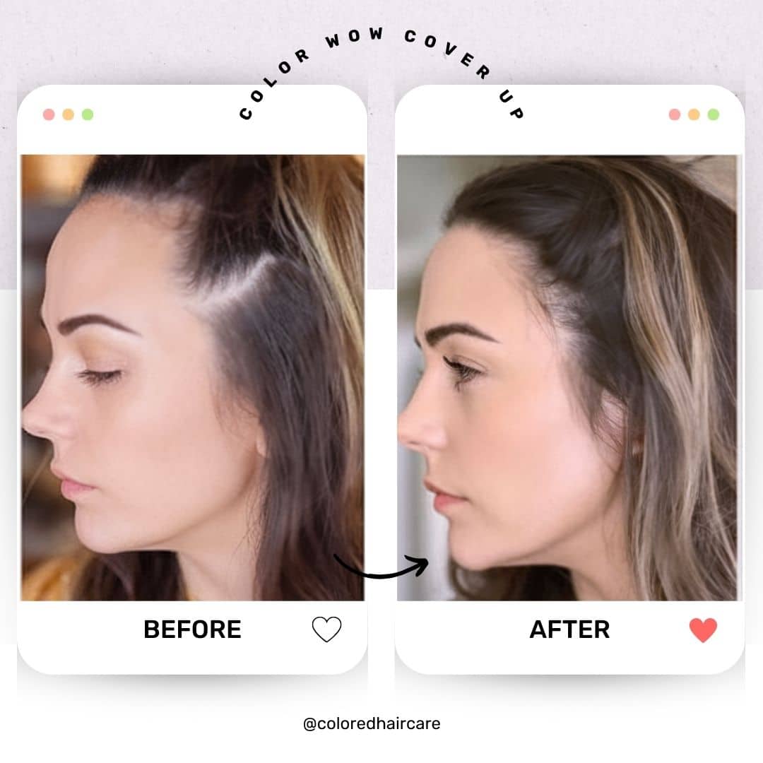 OMG, My Hair Is Vanishing! The Miracle Fix That Saved My Sanity (And My ...